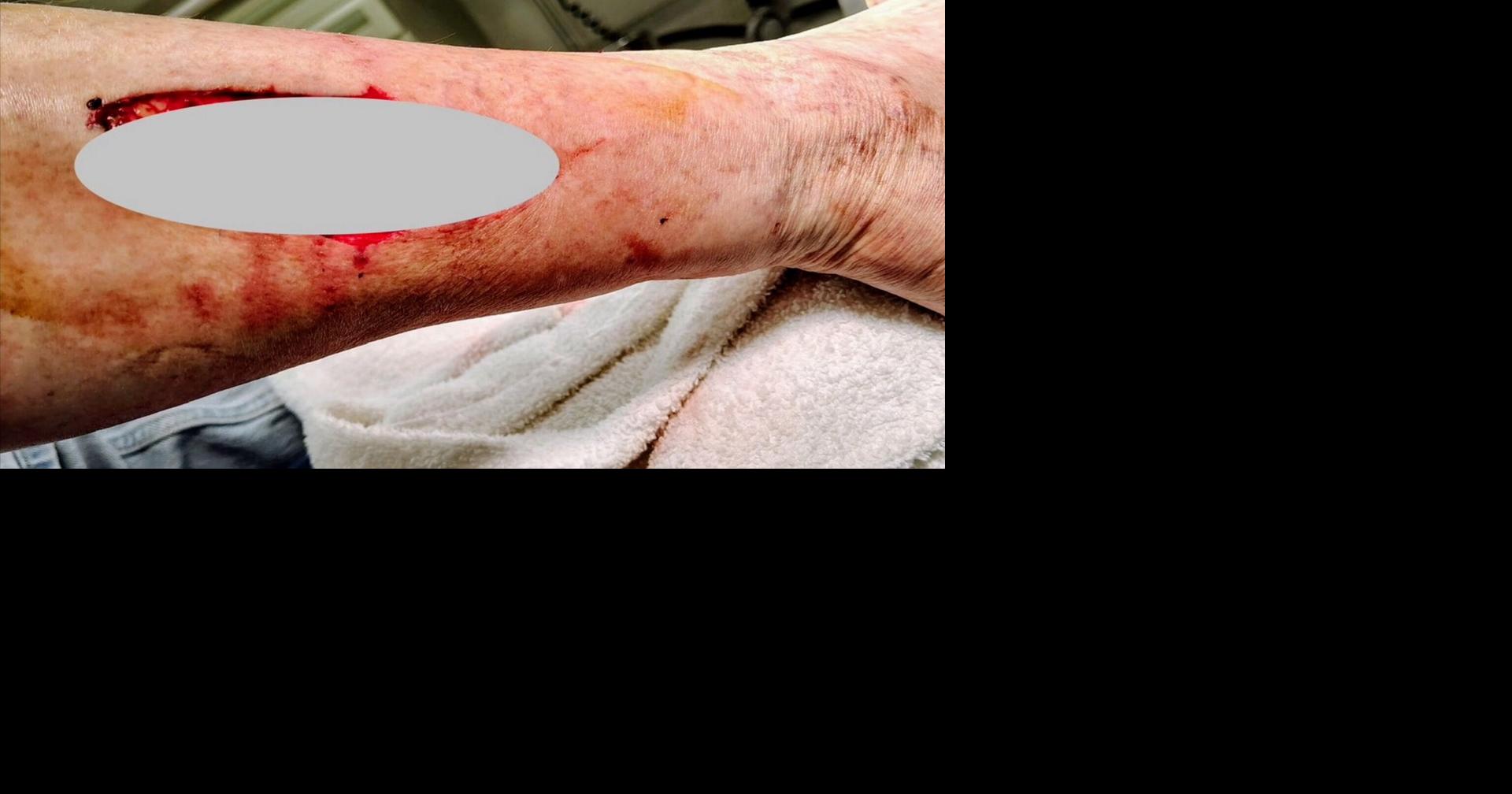 Dog attacked man at Baldwyn gas station | | wtva.com