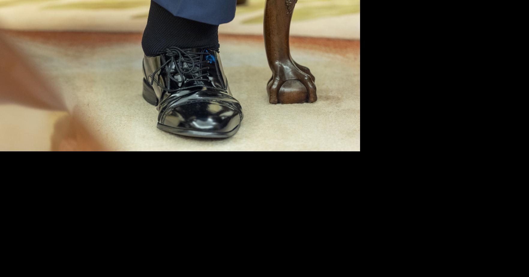 What to know: Trump's chronic venous insufficiency diagnosis | Health ...