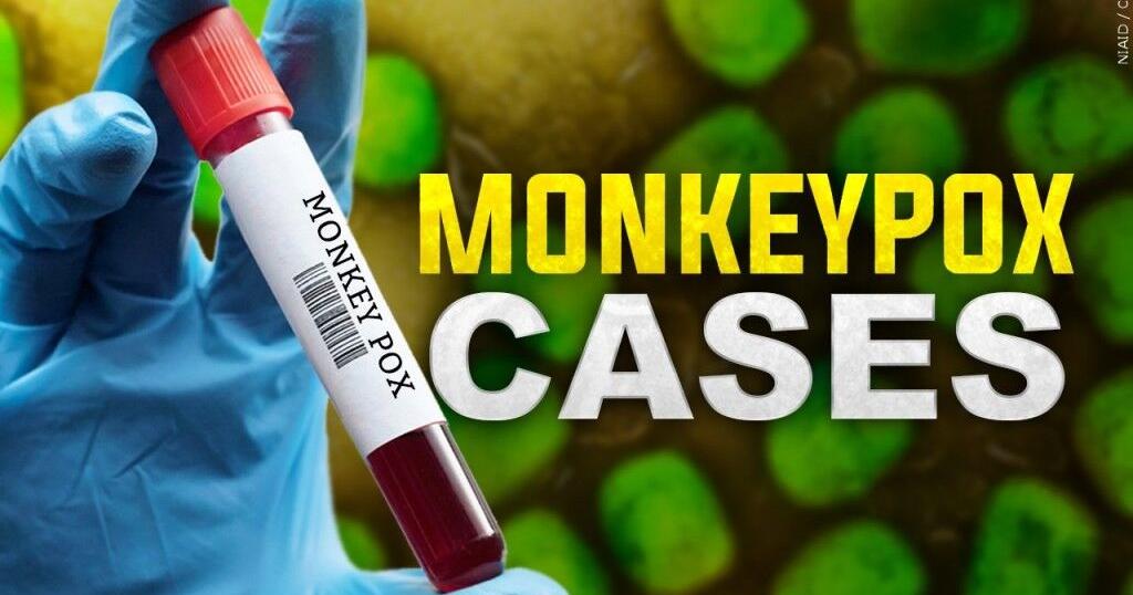 Monkeypox can spread to pet dogs, doctors report | Regional & U.S. News ...