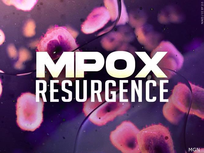 Mpox outbreaks in Africa declared a global health emergency. What is ...