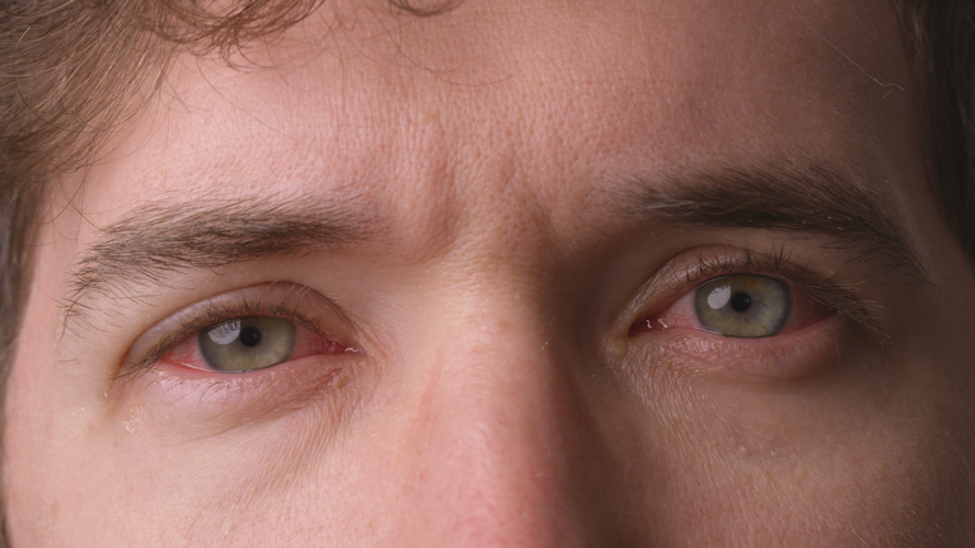 Coulee Region seeing uptick in Pink Eye | Health | wxow.com