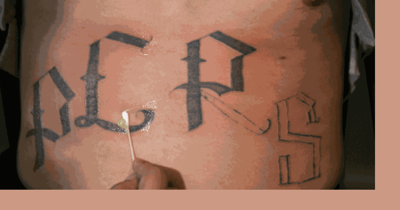 How a gang tattoo removal program is helping people start fresh ...