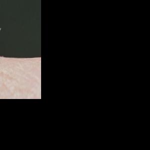 Medical Monday: Dealing with mosquitos | Wake Up Wisconsin | wxow.com