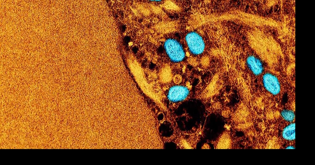 Mpox declared a global health emergency | Video | wxow.com