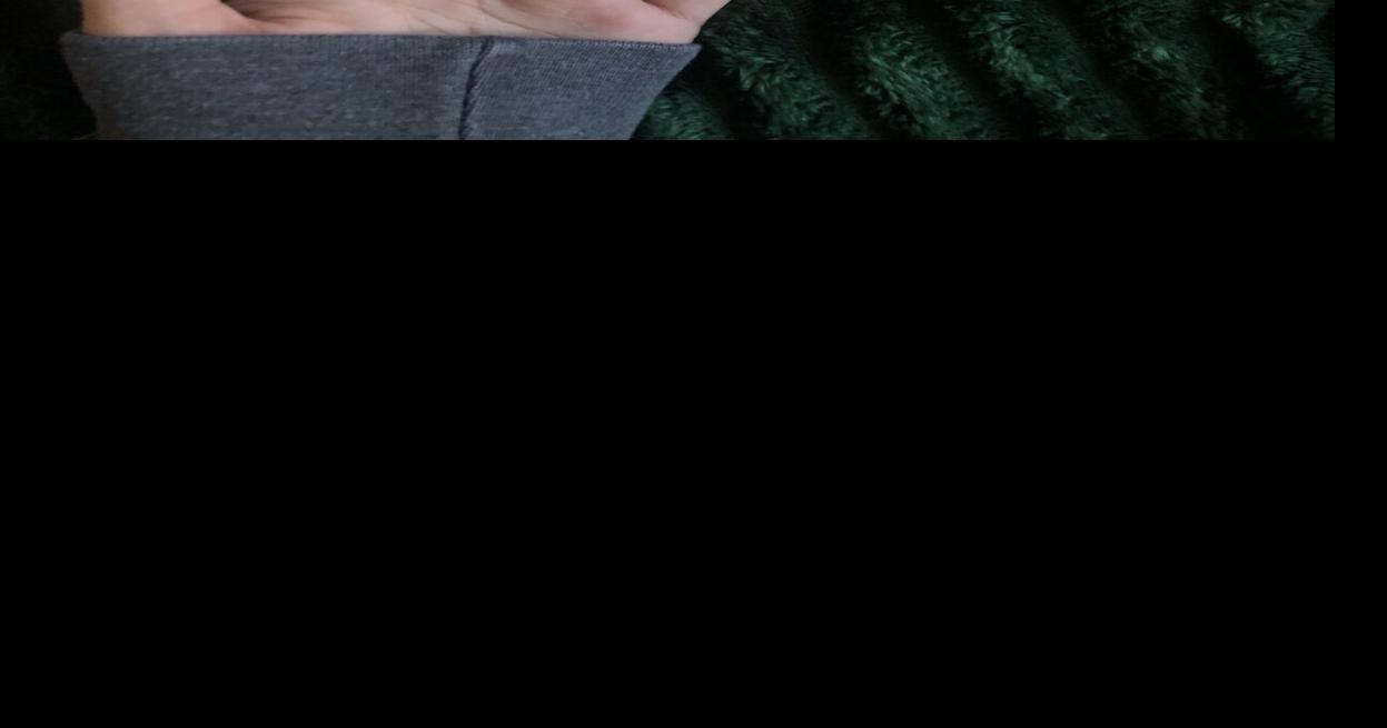 Where did I find my solution to skin problems? Under a green cap ...