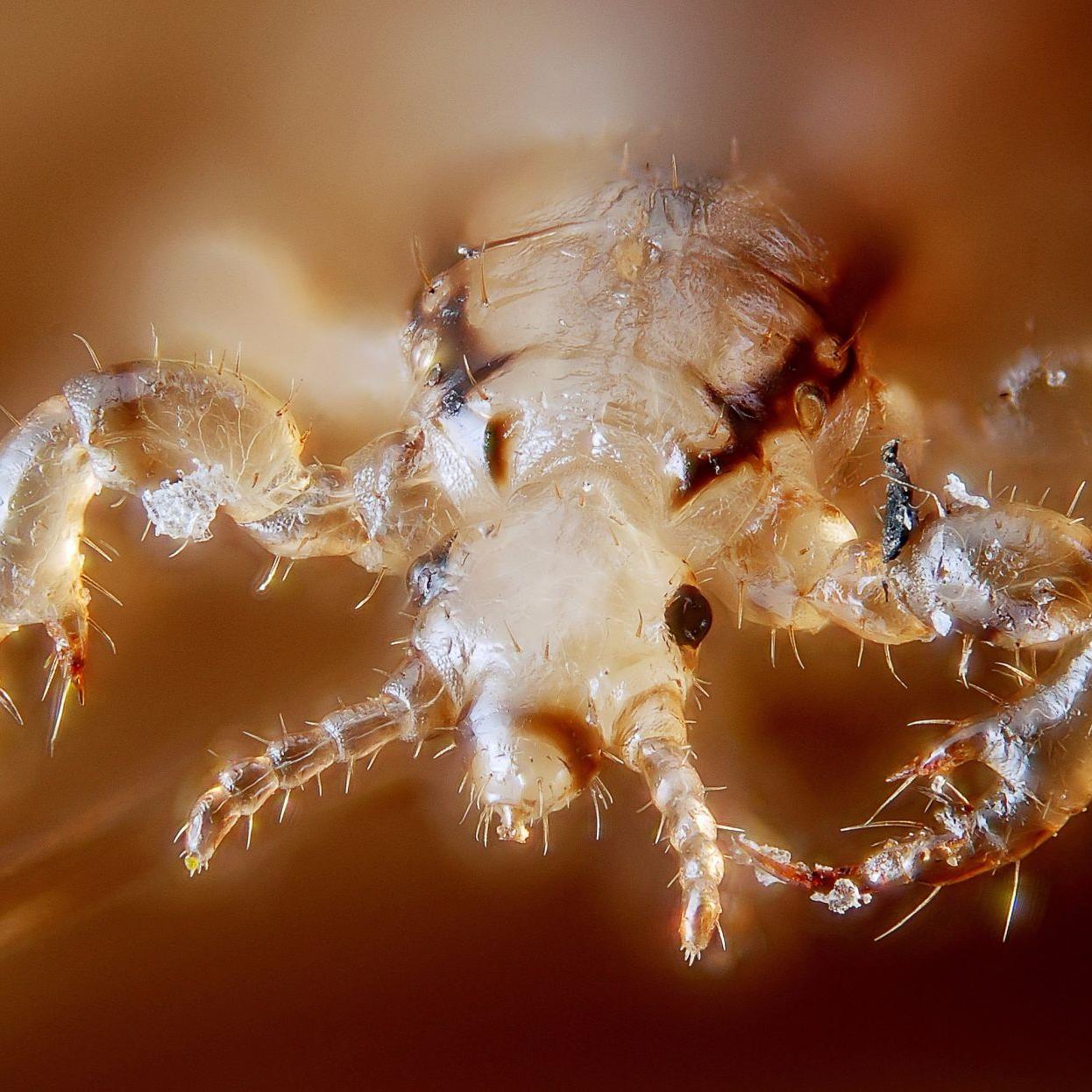 lice close up face