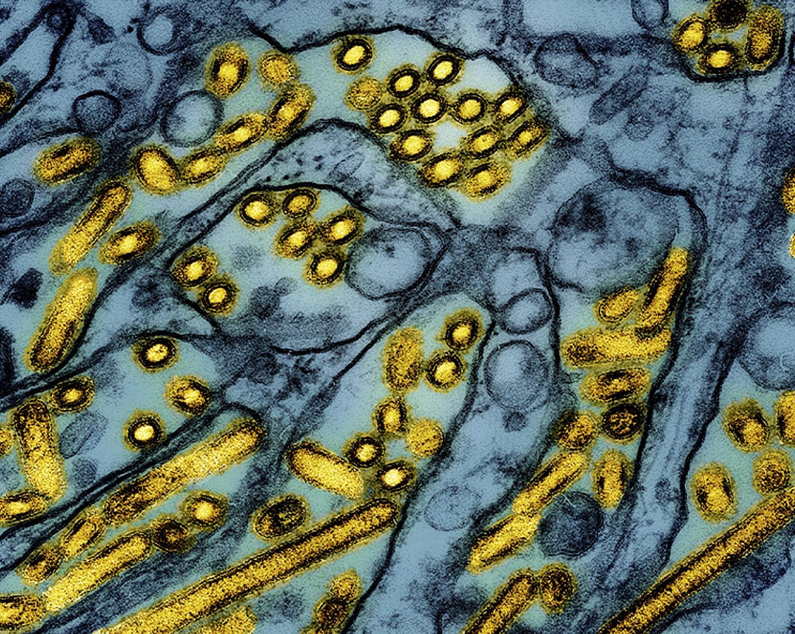 Backyard flock tests positive for bird flu in Yakima County | Local ...