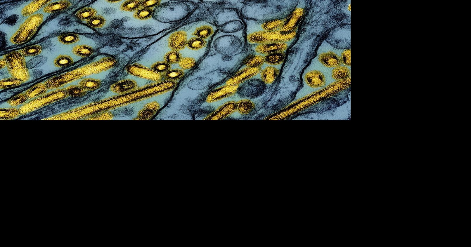 Backyard flock tests positive for bird flu in Yakima County | Local ...