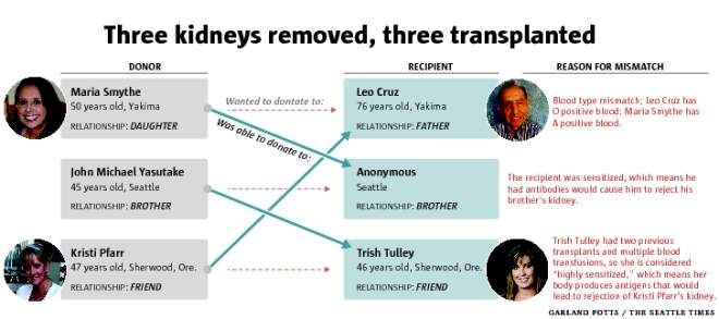 Three-way kidney swap shortens wait for Yakima patient | Northwest ...