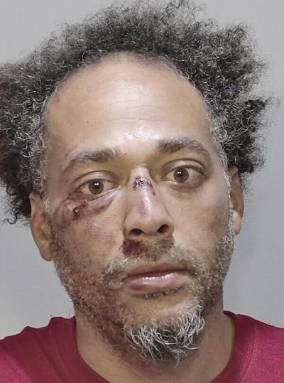 Hospital patient accused of battery, Tased | APG State News | yoursun.com