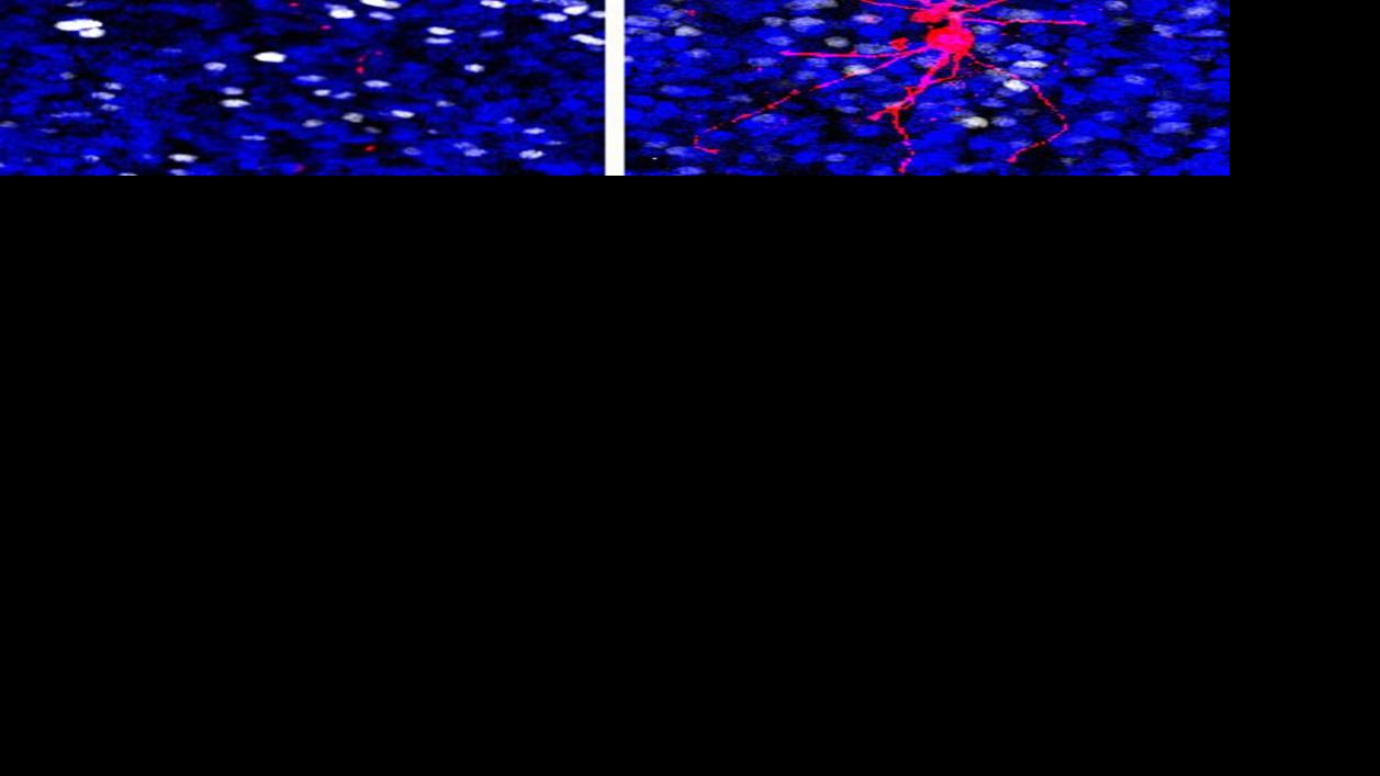 New autism research on single neurons suggests signaling problems in ...